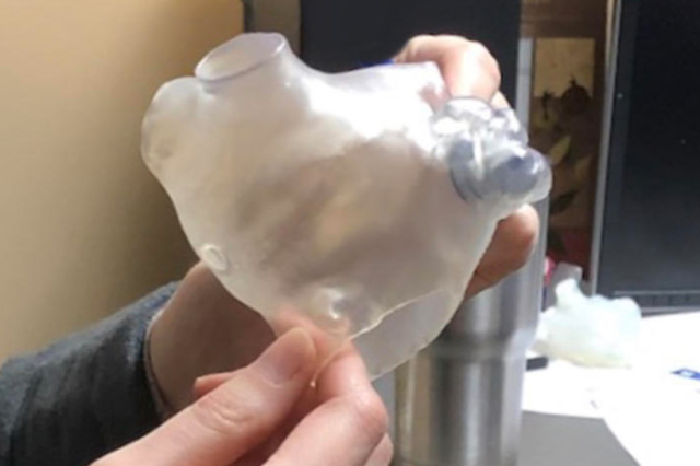 How a $5 plastic heart is improving surgery at UK