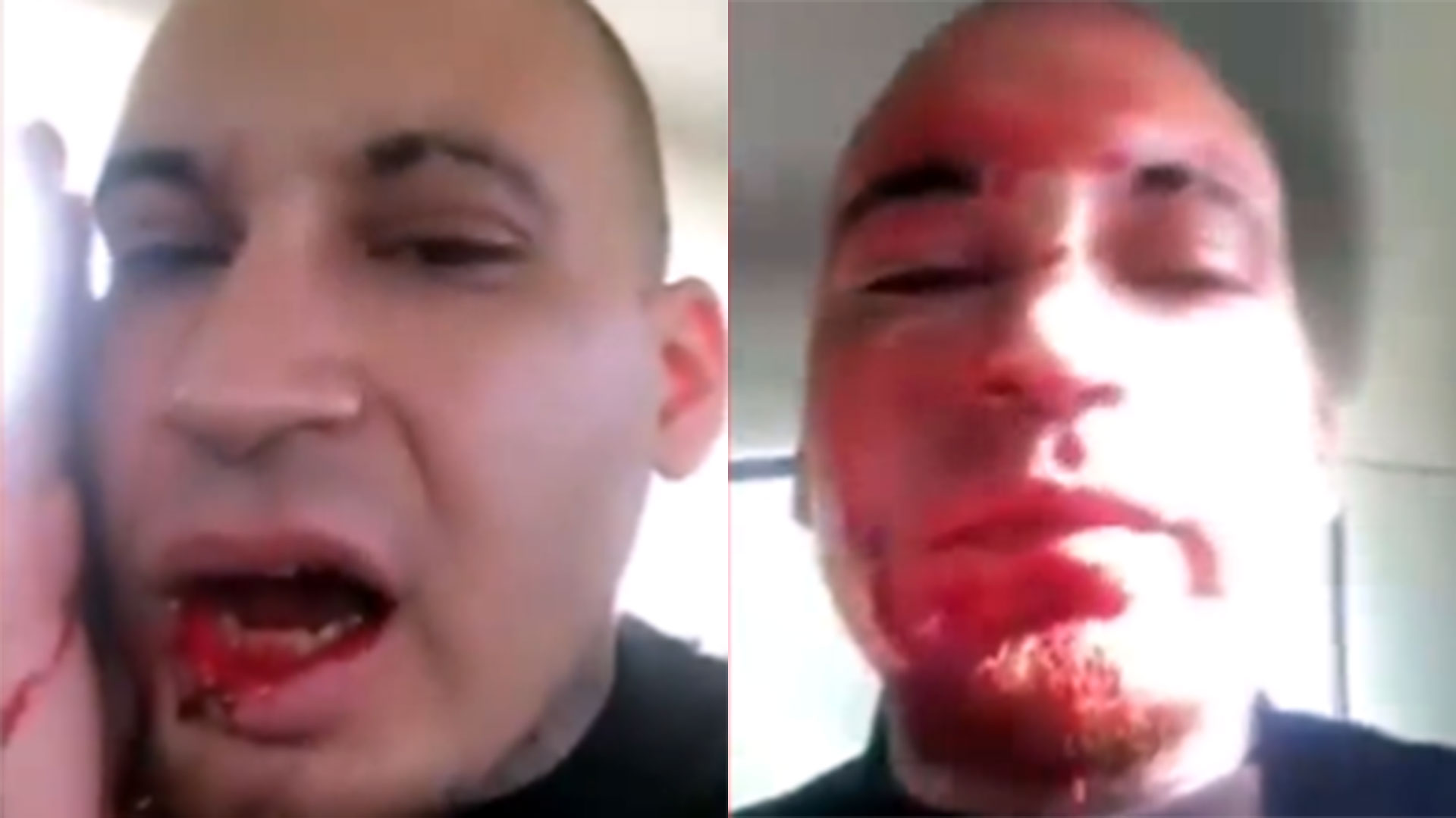 El rapero Kasper Knight se disparó en una mejilla para su nuevo video ...