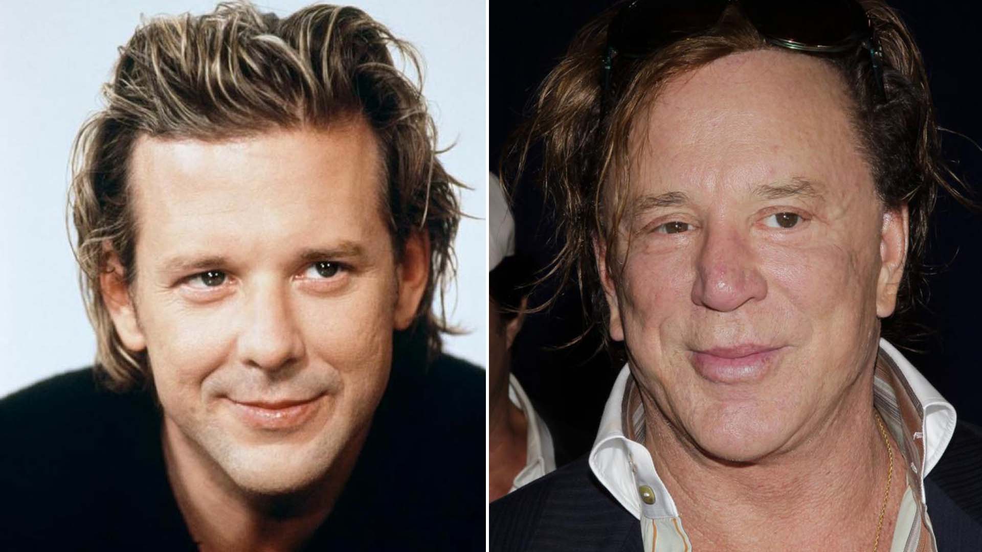 El rostro de Mickey Rourke vuelve a hacerse viral por su abuso de ...
