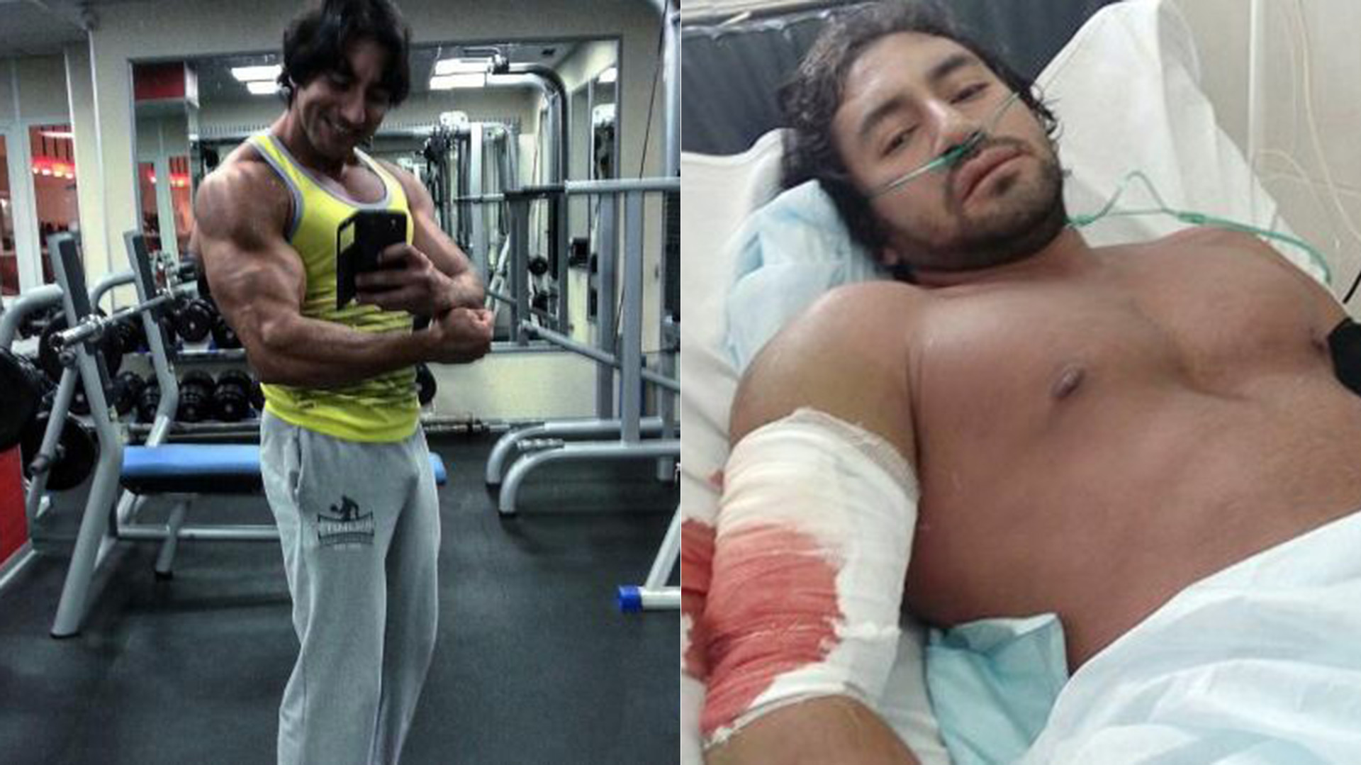 Conmoción Por La Muerte De Un Fisicoculturista Colombiano Que Se