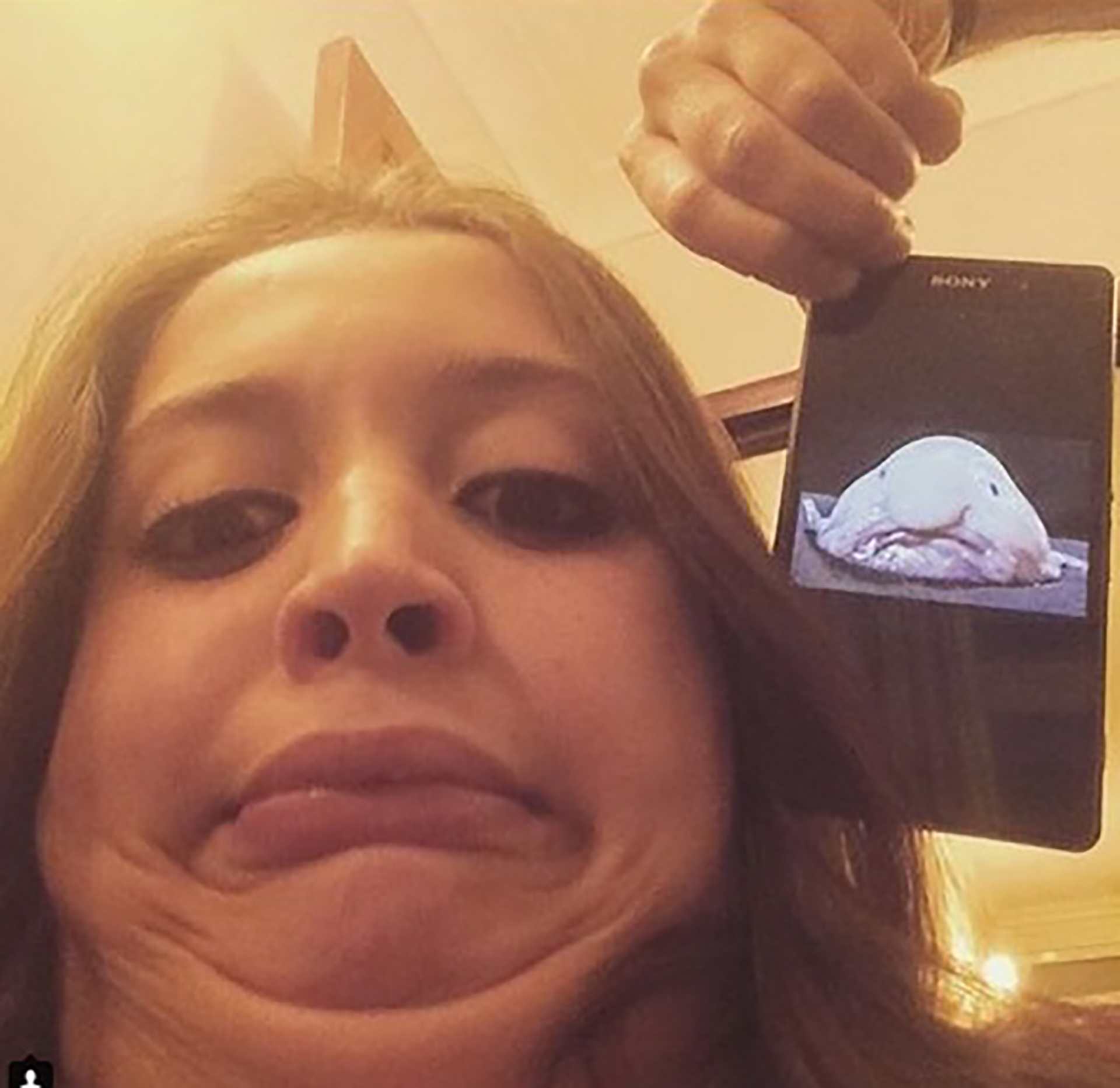 La Papada De Esta Chica Es La Nueva Sensación De Instagram Infobae
