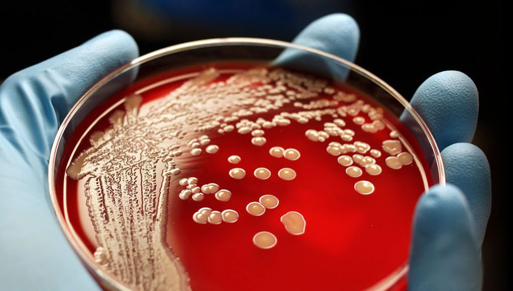 Identifican la base molecular de las bacterias resistentes a ...