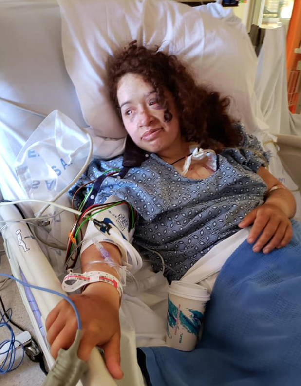 La increíble historia de la joven que cayó por un acantilado con su ...