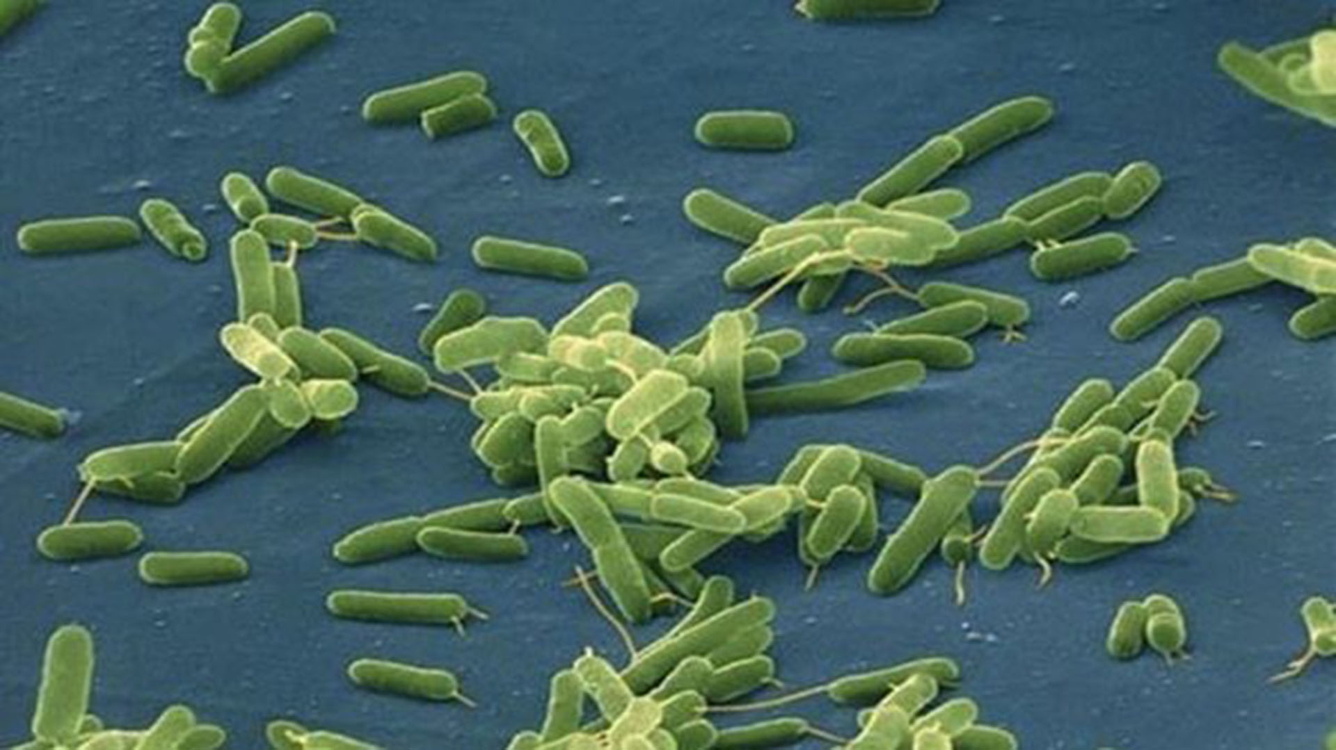 Qué es vibrio vulnificus, la bacteria del mar que mata a más del 20% de ...