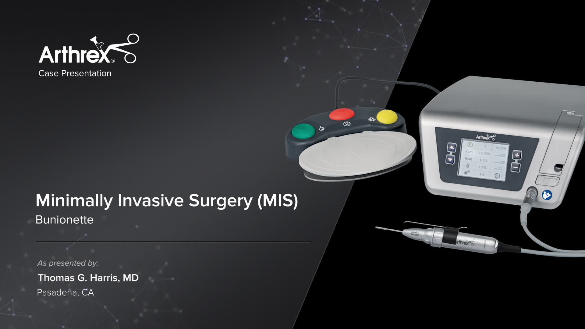 Arthrex - Minimally Invasive Surgery (MIS) Bunionette