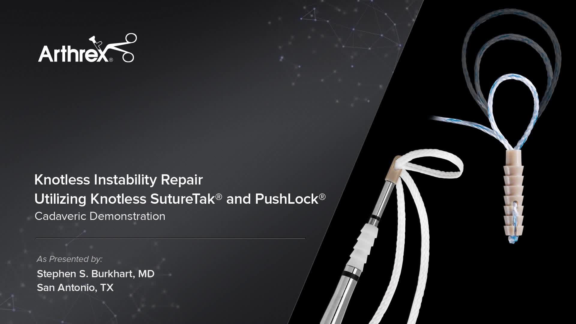 Arthrex - Knotless Instability Repair Utilizing Knotless SutureTak® and ...