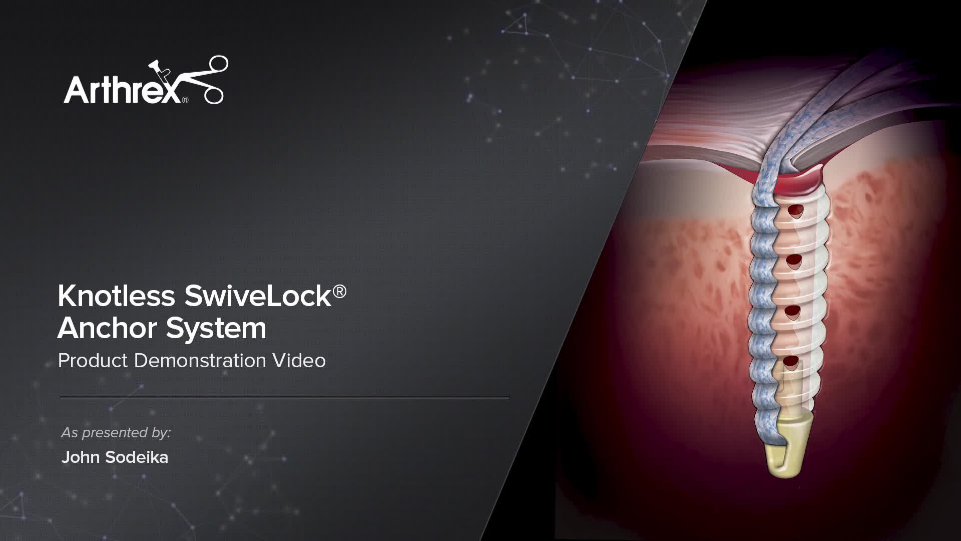 Arthrex - Knotless SwiveLock® Anchor System Product Demonstration Video
