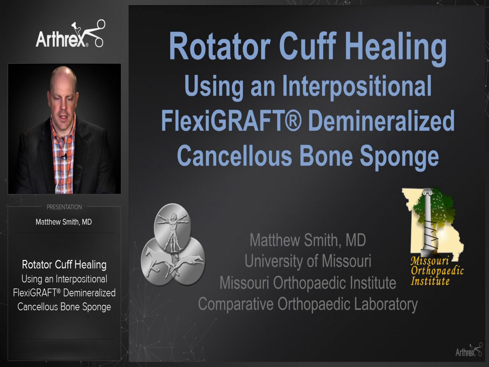 Arthrex - Rotator Cuff Healing Using an Interpositional FlexiGRAFT ...