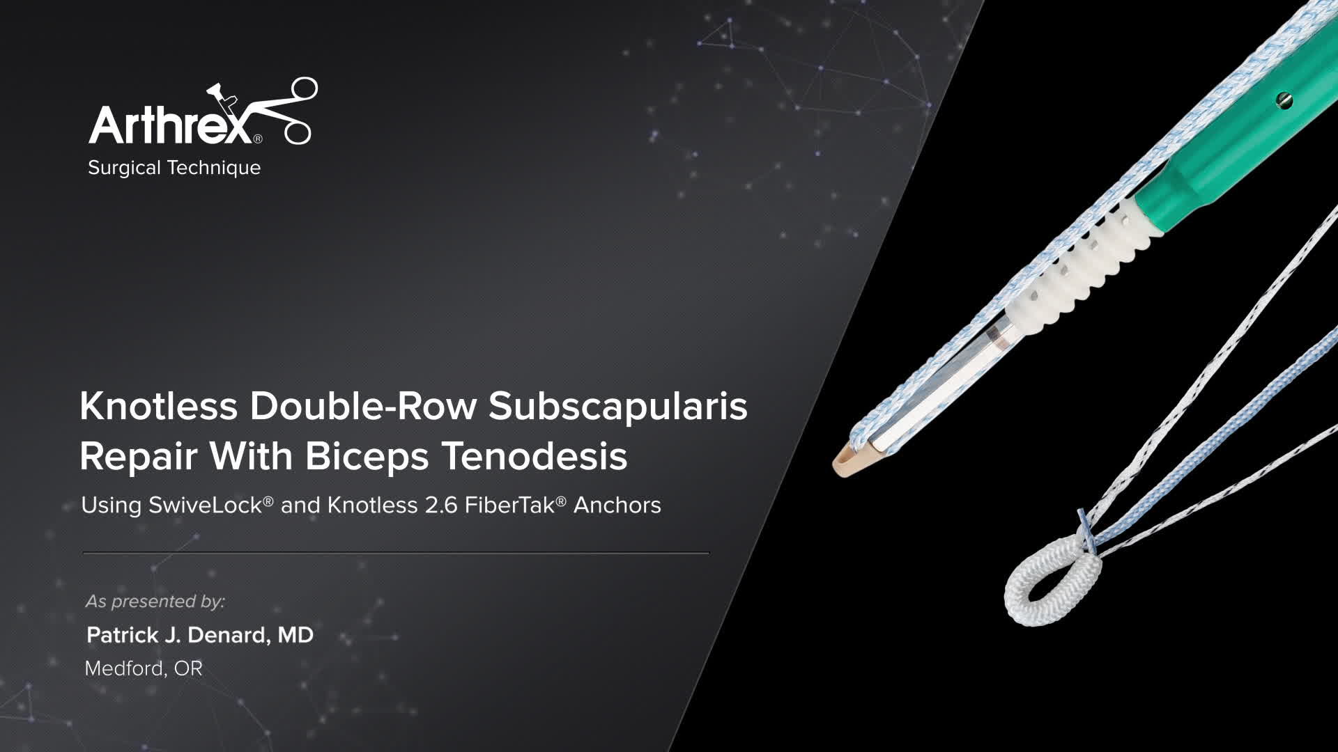 Arthrex - Knotless Double-Row Subscapularis Repair With Biceps ...