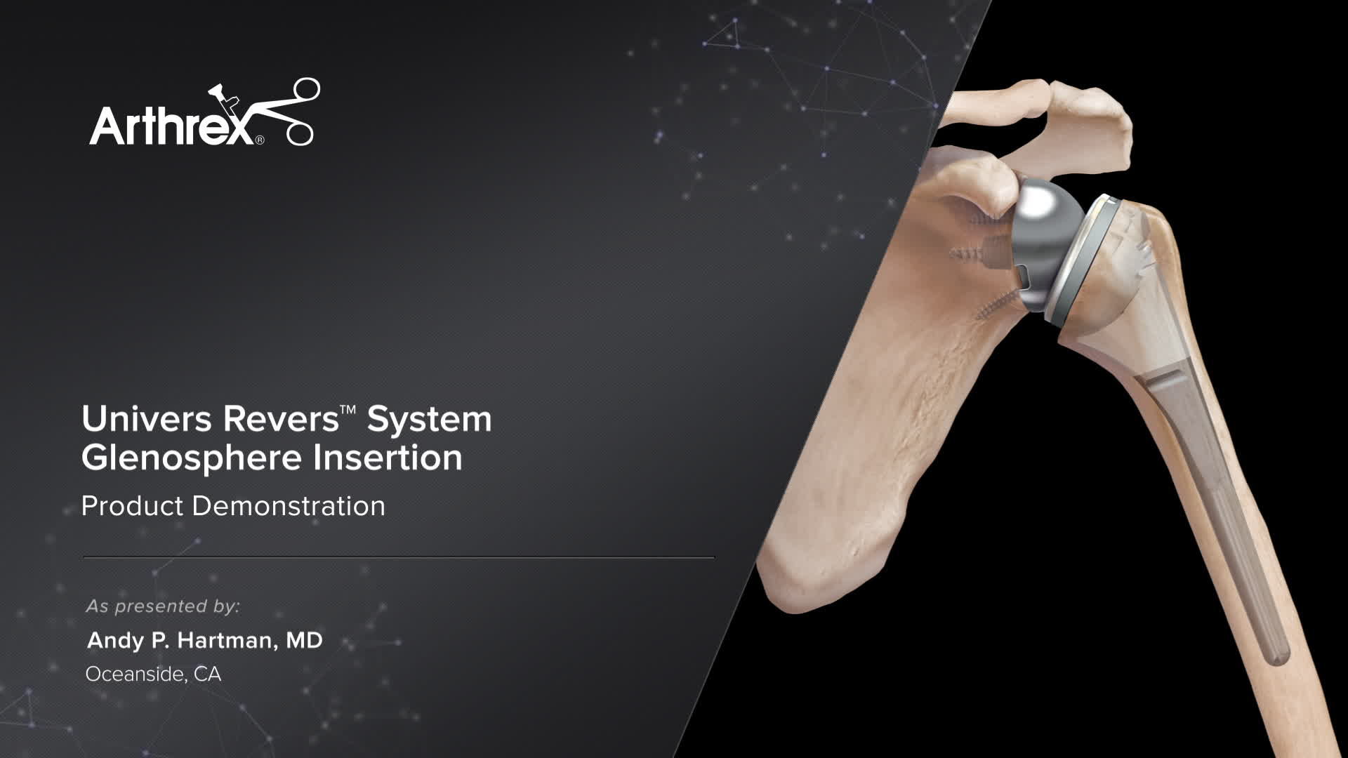 Arthrex - Univers Revers™ System Glenosphere Insertion