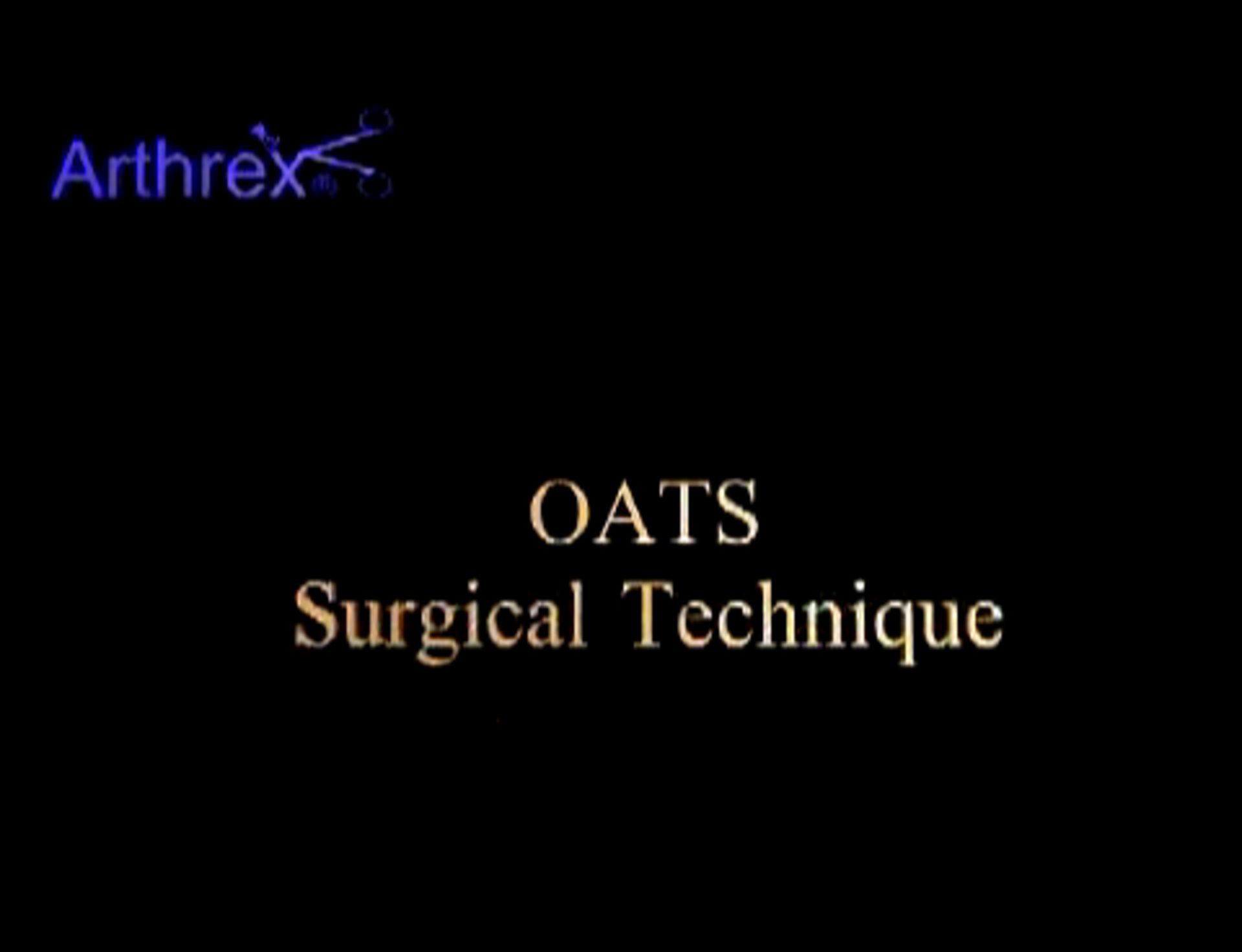 Arthrex - OATS® Surgical Technique
