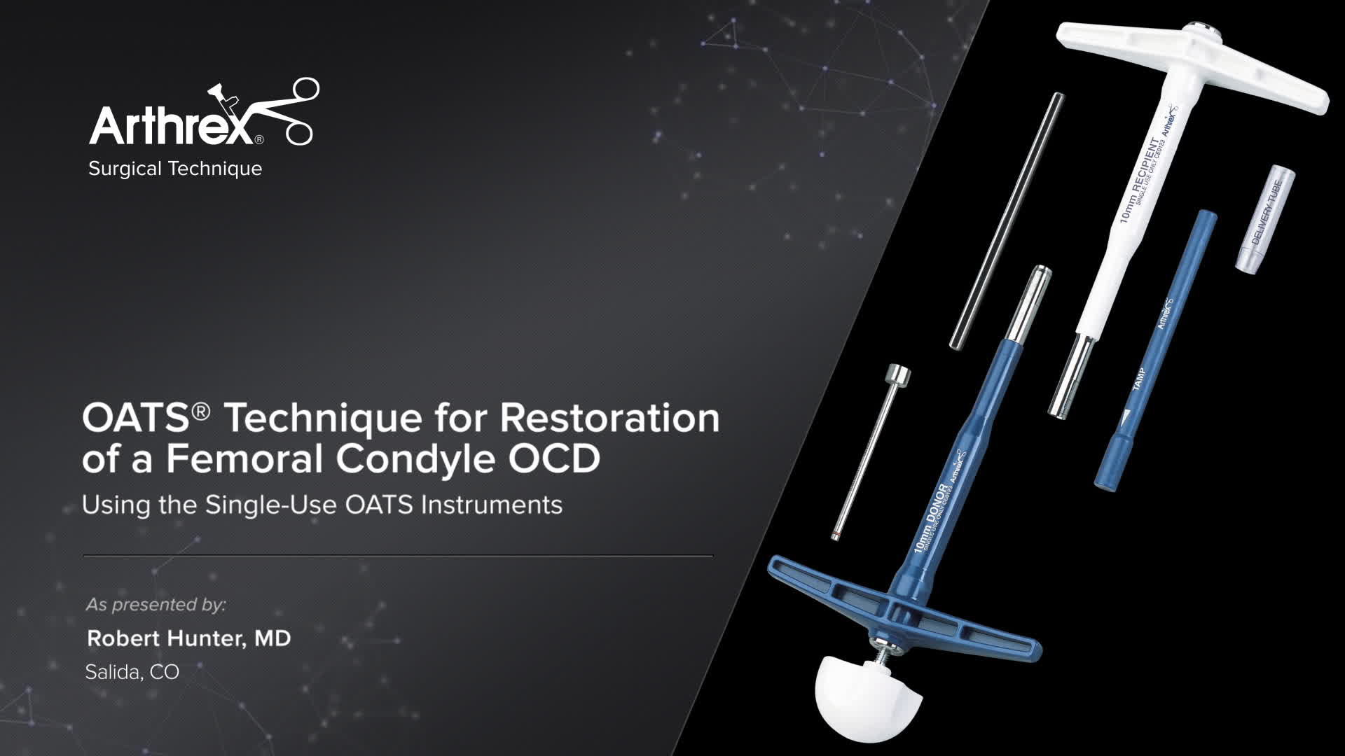 Arthrex - OATS® Technique for Restoration of a Femoral Condyle OCD ...