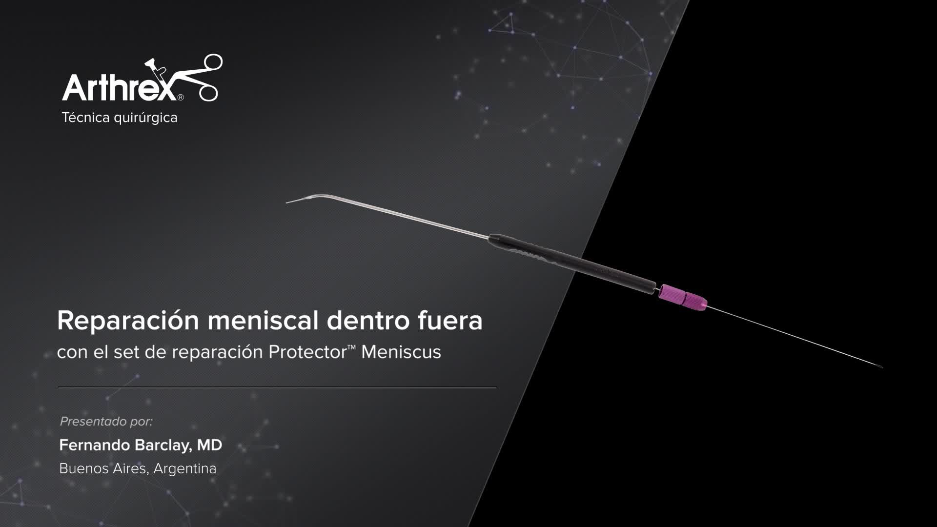 Arthrex - Reparación meniscal dentro fuera con el set de reparación ...