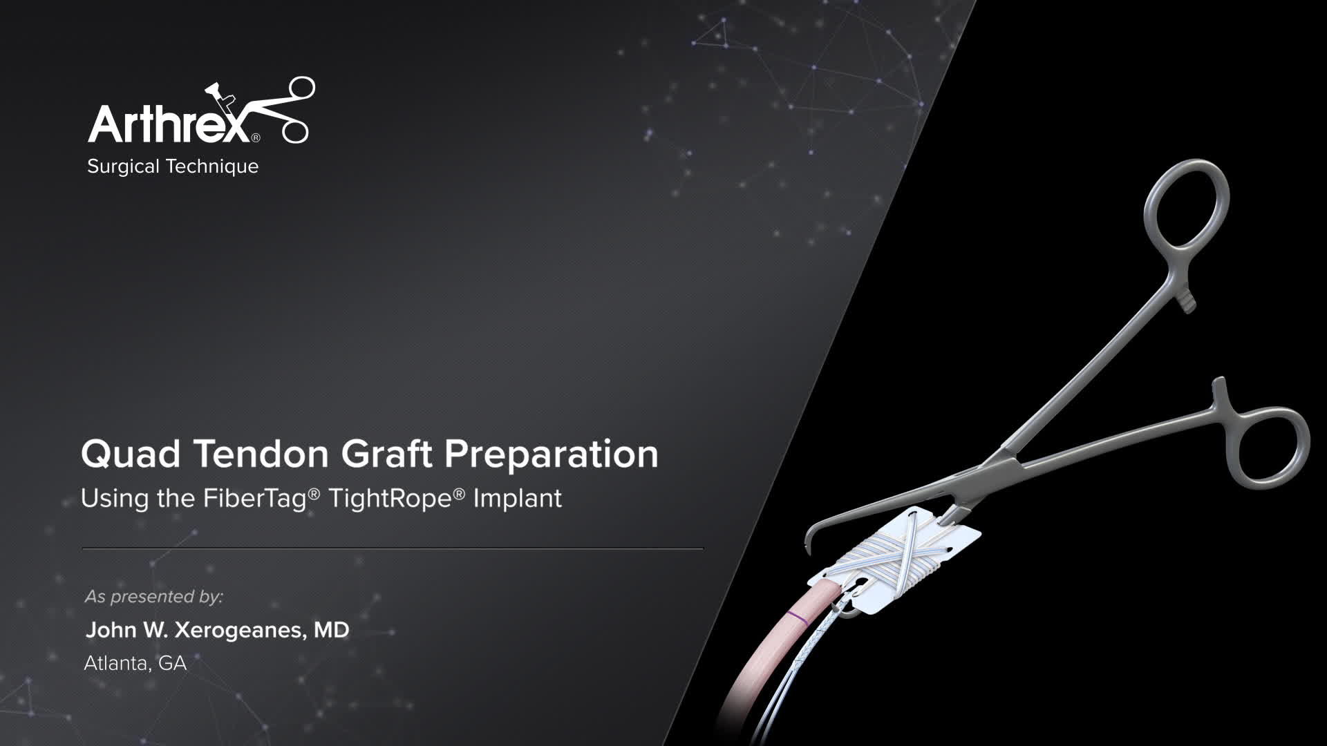 Arthrex - Quad Tendon Graft Preparation Using the FiberTag® TightRope ...