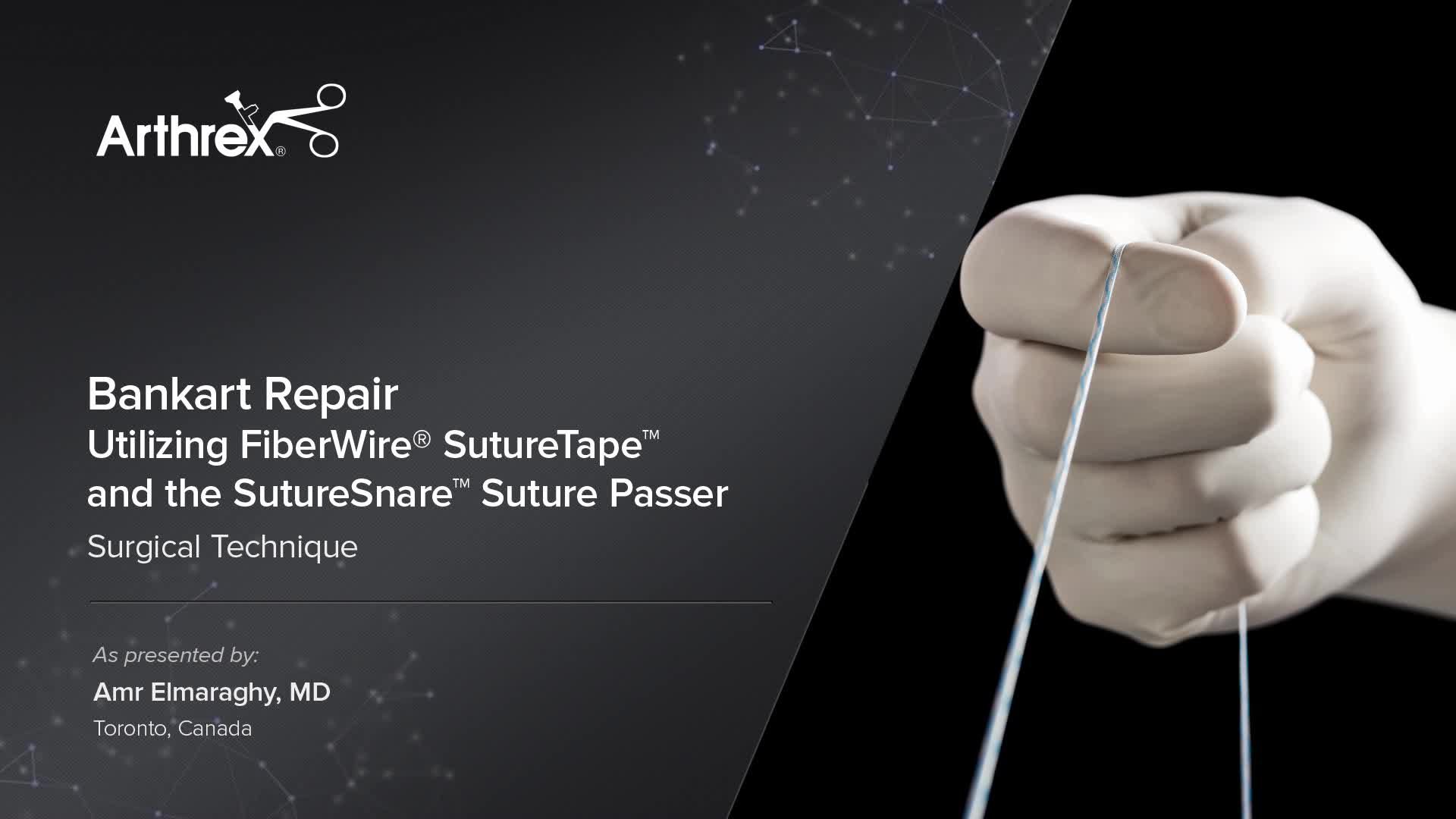 Arthrex - Bankart Repair Utilizing FiberWire® SutureTape™ and the ...