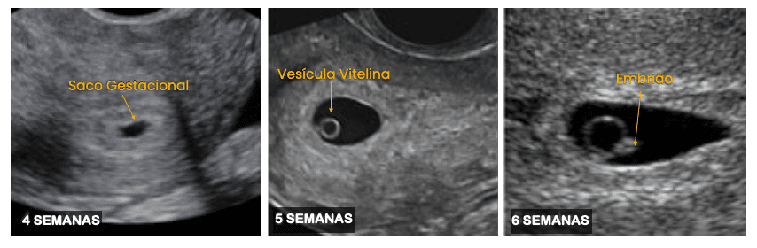 Descobrindo a Magia: Quando Realizar o Primeiro Ultrassom