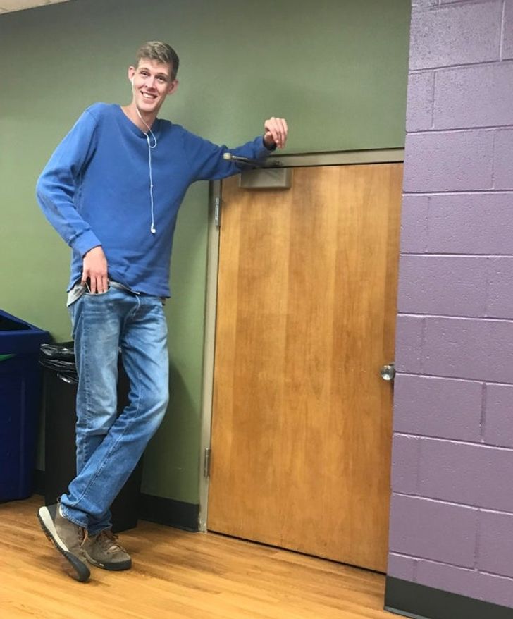 12 Pics of People Gifted With Unique Physical Traits - AsViral