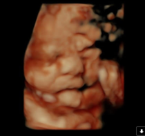 Luca Moyer's Arrival — A Baby Pool on Baby Bookie