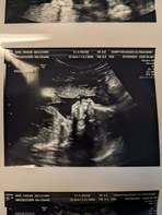 Baby Taylor Tally — A Baby Pool on Baby Bookie