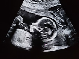 Kinsey ( Ryan's Daughter) — A Baby Pool on Baby Bookie