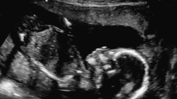 Choose Our Baby's Middle Name! — A Baby Pool on Baby Bookie