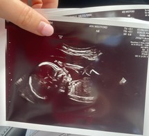 Scarlett Foley - Baby Bets — A Baby Pool on Baby Bookie