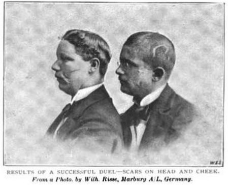 Renommierschmiss – Academic Fencing Scars