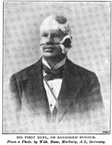 Renommierschmiss – Academic Fencing Scars