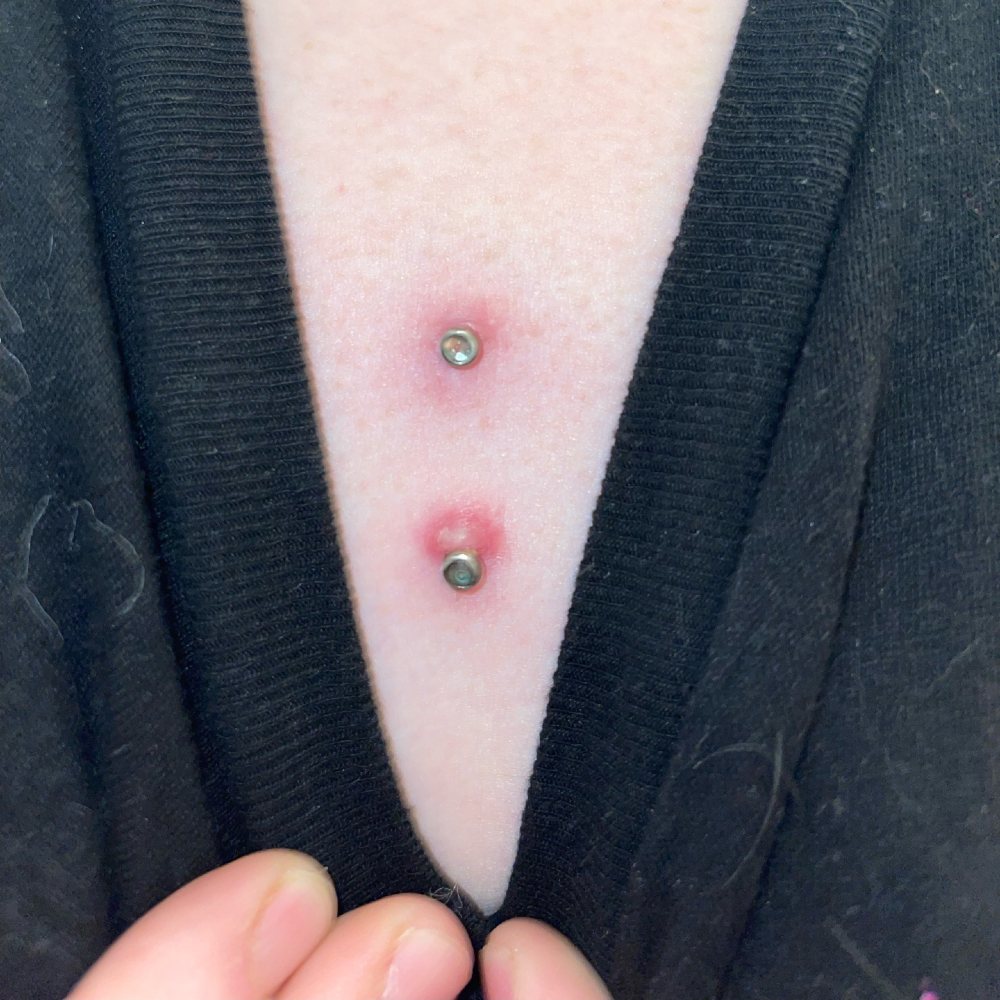 Piercing Problems To Watch Out For And What To Do