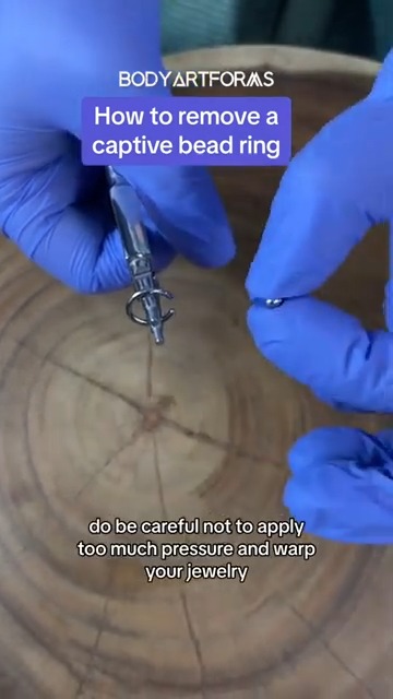 Captive Bead Ring Removal And Reinsertion