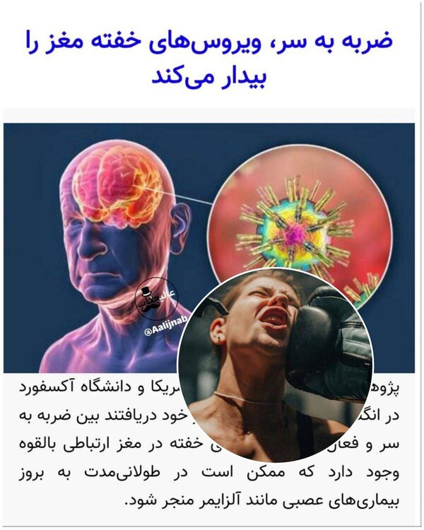 بالاترین یک ضربه به سر یک ویروس خفته در مغز را فعال می کند و باعث