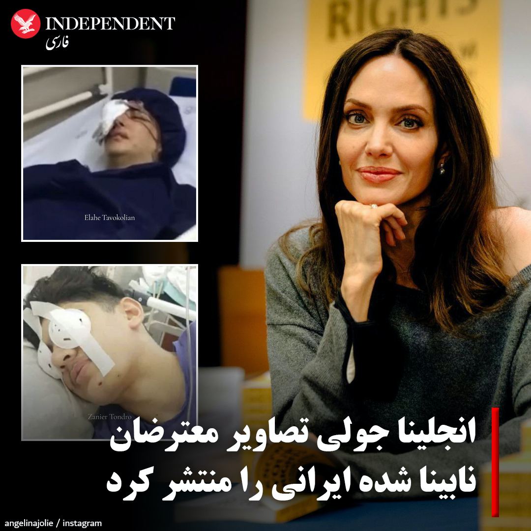 بالاترین «انجلینا جولی تصاویر معترضان نابینا شده ایرانی را منتشر کرد ~عکس