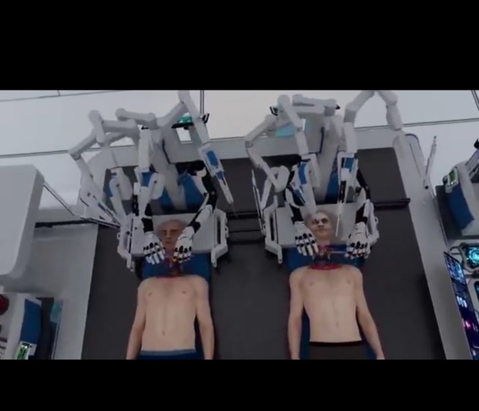 بالاترین: تکنولوژی شگفت‌انگز تعویض "سر و بدن" / ویدیو + توضیحات