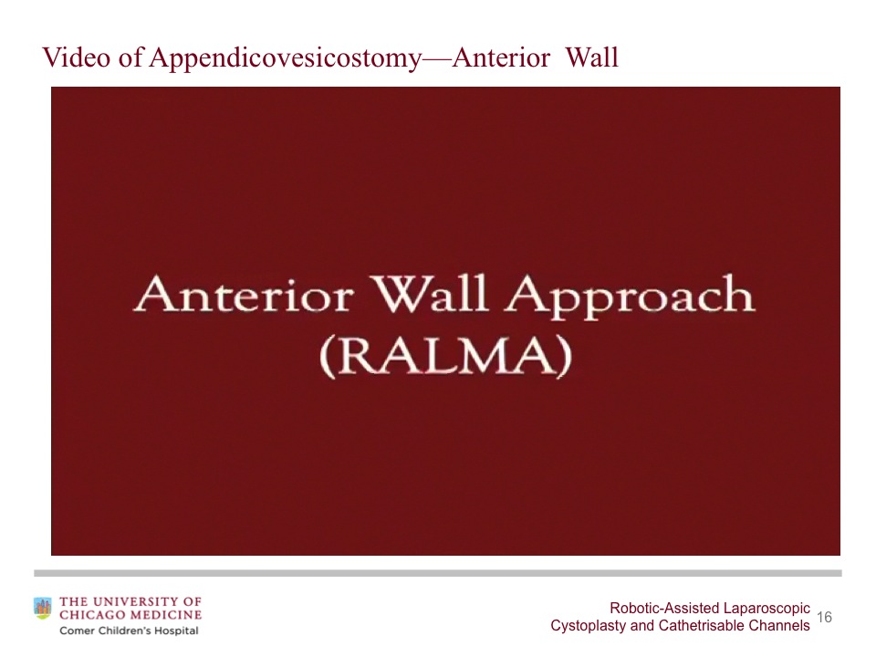 Appendicovesicostomy