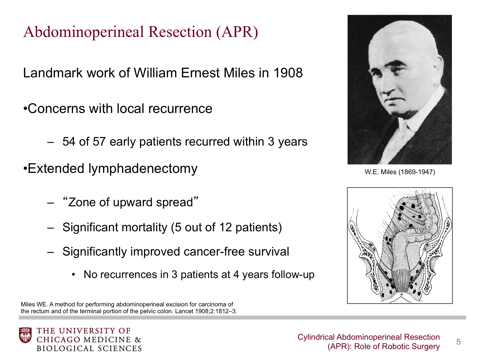 Abdominoperineal Resection Steps