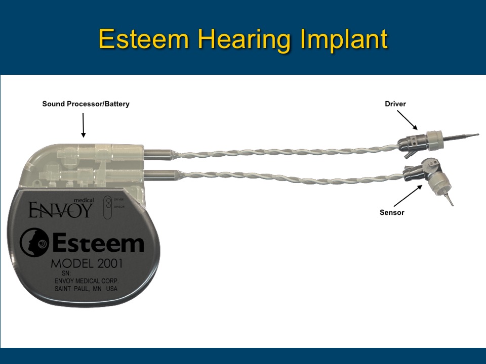 Esteem Cochlear Implant