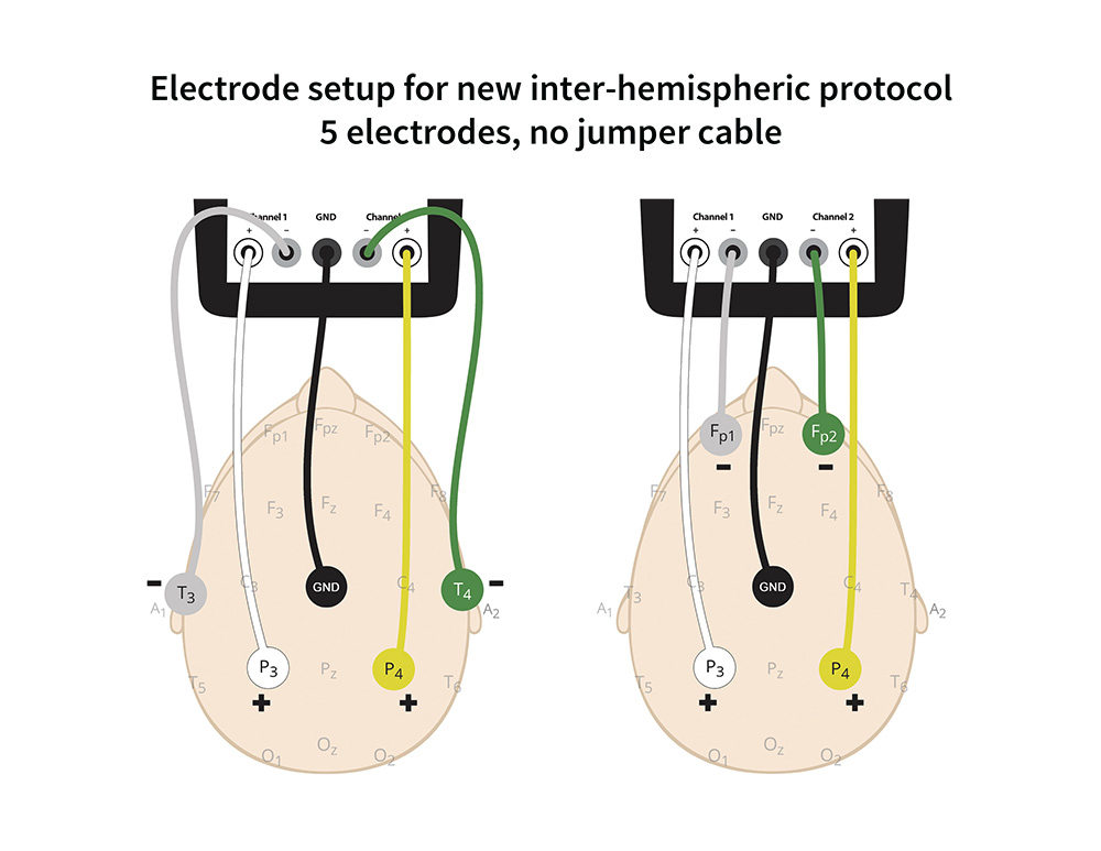 Tech Support | EEG Info