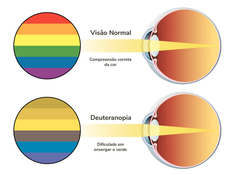 Será que meu filho tem daltonismo ou só confunde as cores?