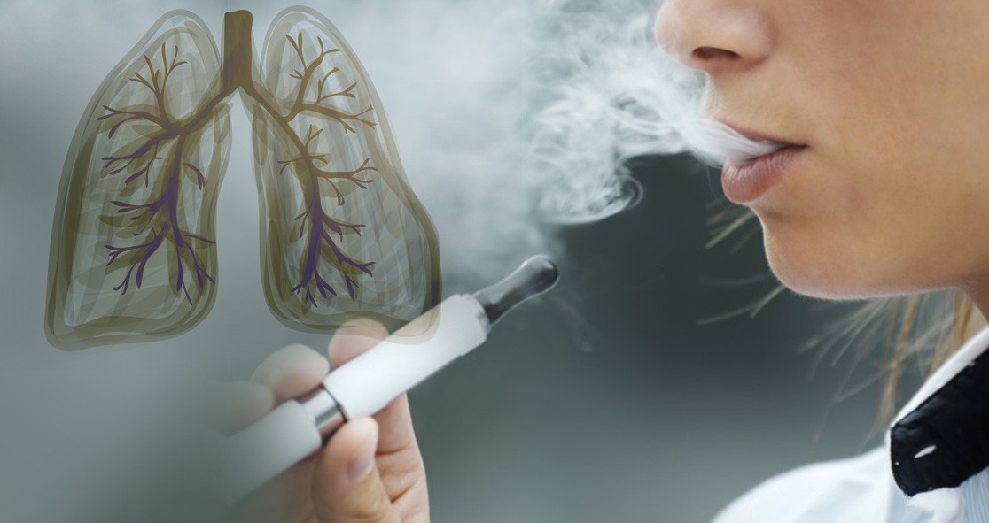 Quitting Vaping for Lung Recovery - The Power of Quitting
