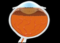 Understanding the Dropped Nucleus | Volume 25, Issue 2 - Video Journal ...