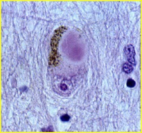 Rod Shaped Blepharoplasts