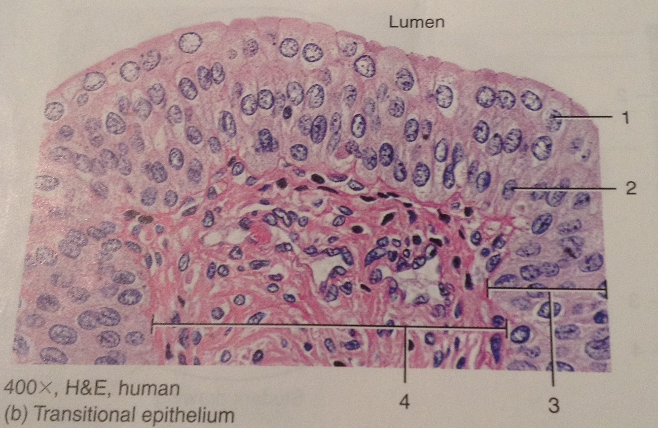 Transitional Epithelium Labeled 400x