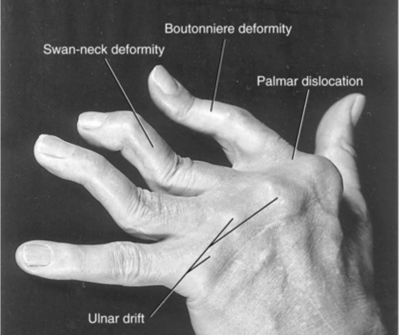 Boutonniere And Swan Neck Finger