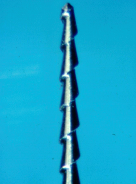 Modified Step Back technique (canal filing) Flashcards by Kayleigh ...