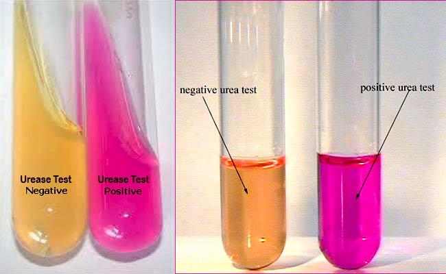 Phenylalanine Deaminase Test