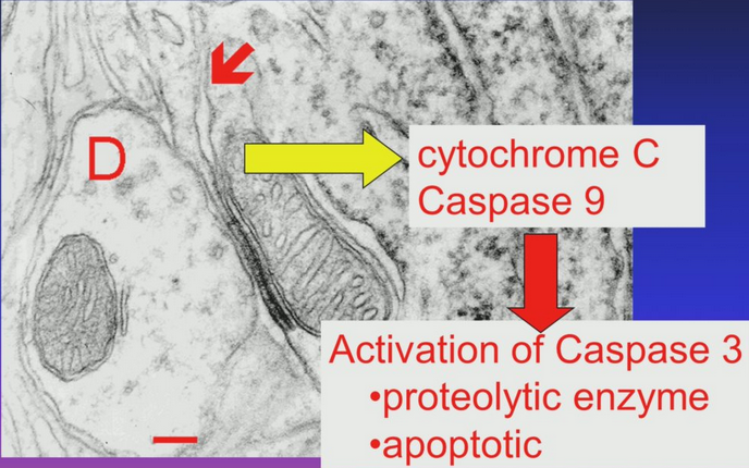 Physiologic Mechanisms of Excitotoxicity Flashcards by Alexander Shinn ...