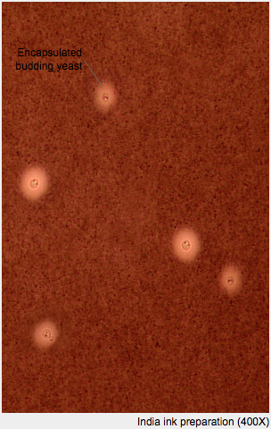 Mycology Flashcards by Claire Chiz