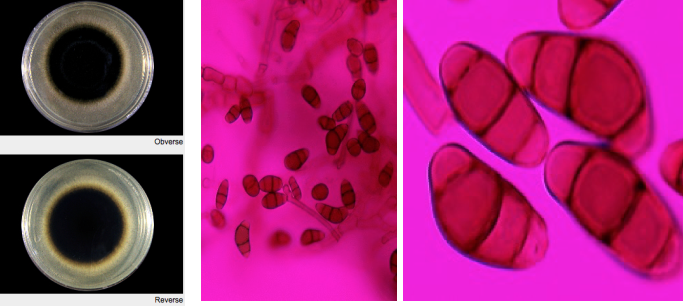 Mycology Flashcards by Claire Chiz | Brainscape