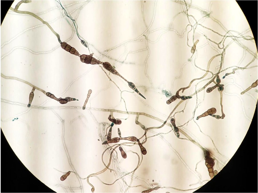 Mycology Flashcards by Claire Chiz