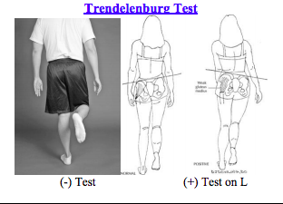 Modified Trendelenburg Test